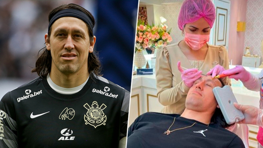 Ídolo do Corinthians, Cássio passa por procedimento estético | LANCE!